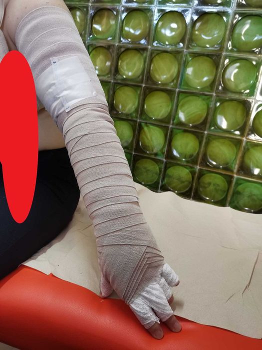 Masaj limfatic limfedem și kinetoterapie la domiciliu Brasov • OLX.ro