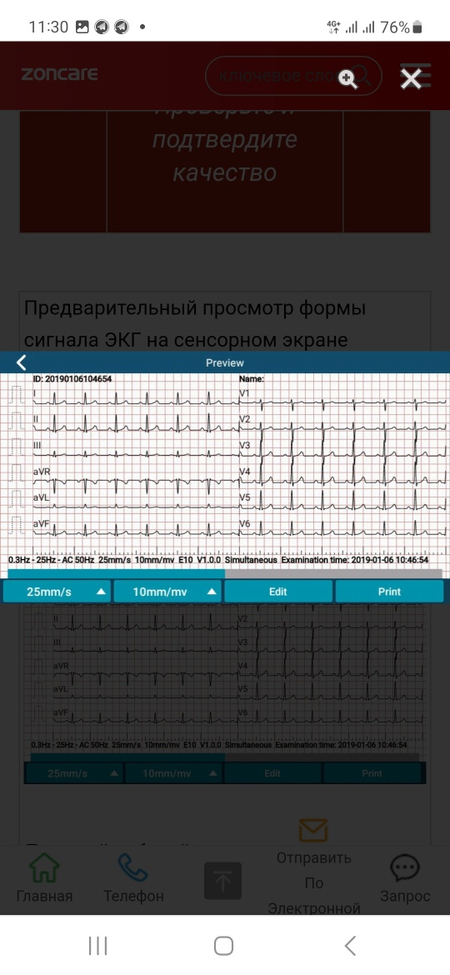 ЭКГ 3 каналный ZONCARE E 10. 
Extreme Simplicity 3-Ch ECG Machine

Нов
