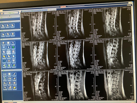 Wandong Open MRI 0.36T  (МРТ 0.3)  2008 Год6Т