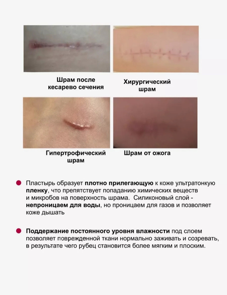 Заживляющий пластырь на силиконовой основе от шрамов