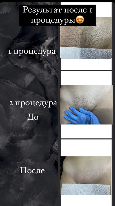 Шугаринг Чирчик только женщинам