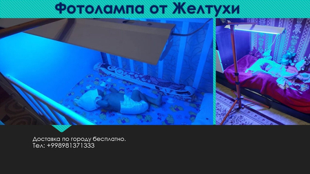 Прокат Фотолампы от желтухи