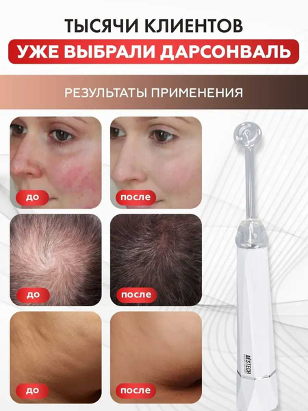 Дарсонваль для лица тела и волос аппарат от морщин и прыщей Darsonval