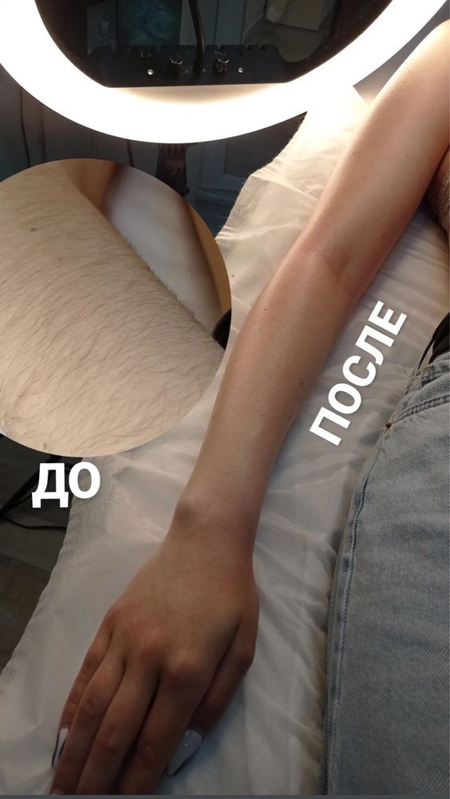 Воскли депиляция аеллар ва эркаклар учун
