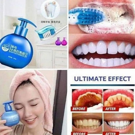 Tishni oqartiruvchi gel - tish pastasi o\\\'rniga - maxsus gel