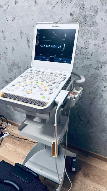 УЗИ портативный Philips