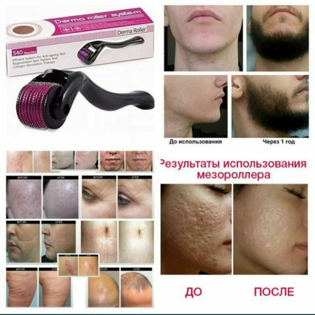Мезароллер оригинал 2мм