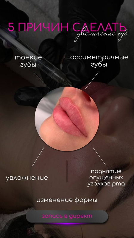 Qizlajonla shoshiling kotta aksiya