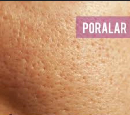 Yuzdagi dog va toshmalar uchun