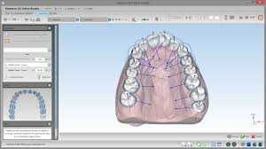 Maestro 3D Dental v6.0, Маэстро 3Д дентал в6