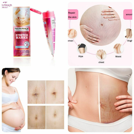 Stretch Mark cream - Крем против растяжек