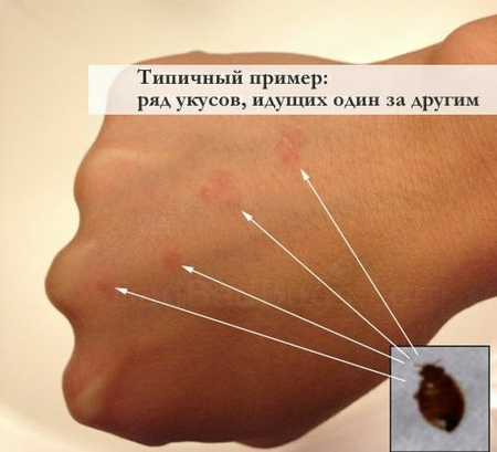 Круглосуточное Дезинфекция от всех видов Вредителей!!!