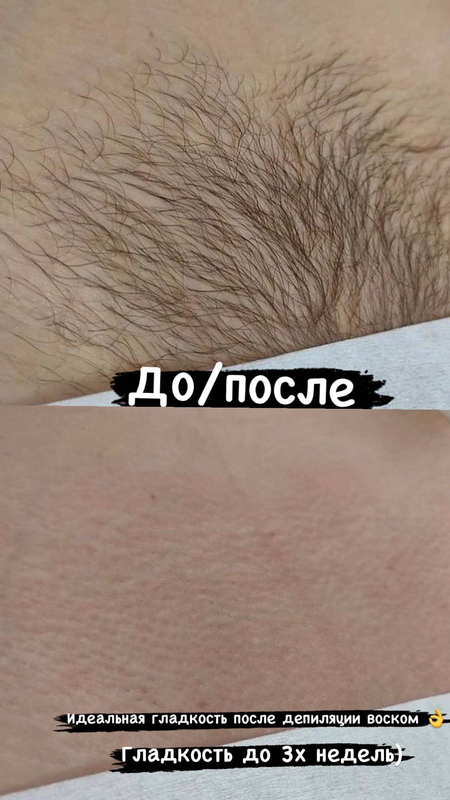Эпиляция Самарканд