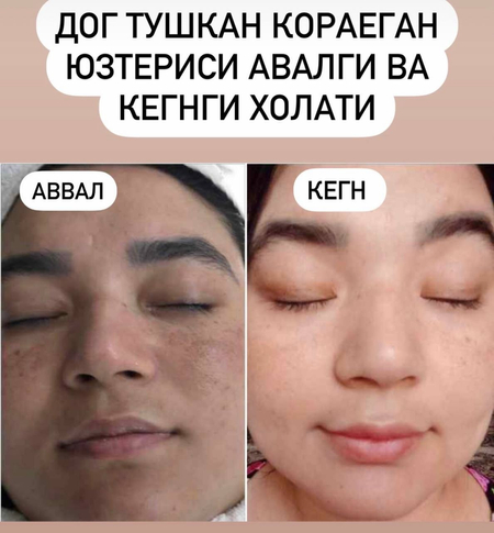 Все косметологические услуги