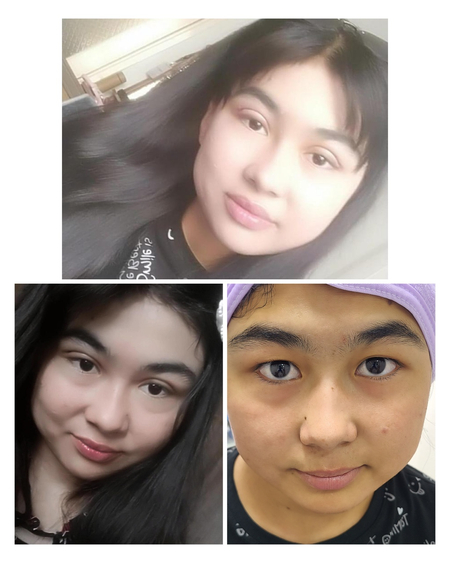 SKIDKADA (Bezoperatsonniy Sangapuri) Browlifting muolajasi