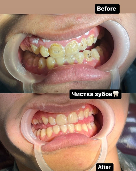 Stomatologiya xizmati taklif qilamz...
