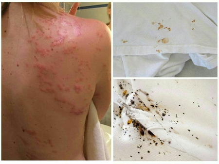 Dizinfeksya islimiz KLAPO ga Qarsi