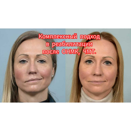 Логопед детям и взрослым