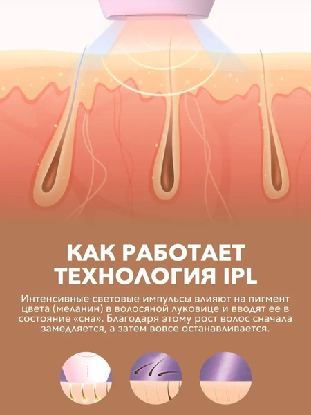 Фотоэпилятор лазерный IPL