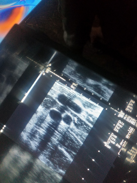Malakali veterinar xizmati (UZI) ultratovush tekshiruvlari xam mavjud.