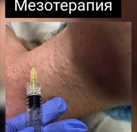 Barcha kosmetolog prosiduralari