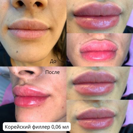 Косметолог для женщин