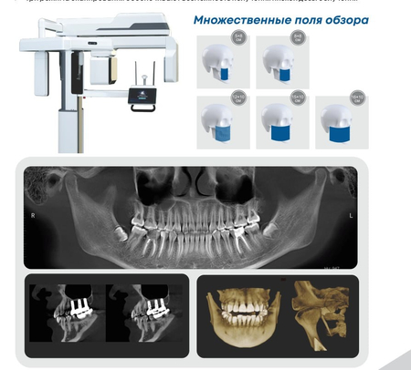 3D-рентгеновское устройство. Дентальный 3Д рентген панорамный