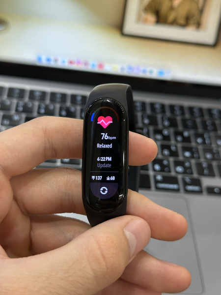 Mi band 6 global