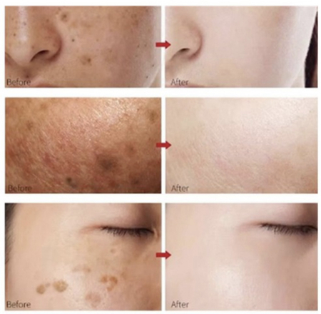 Retinol Mooyam brendi