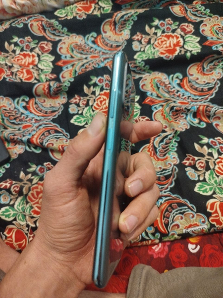 Redmi note 10 kelishamz