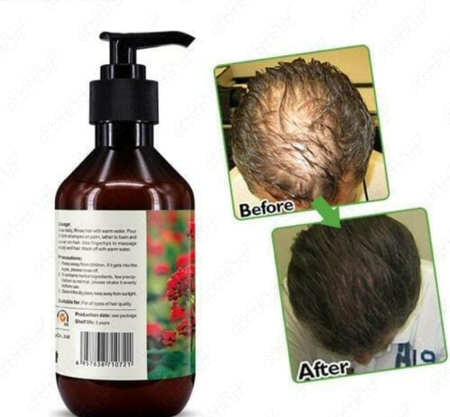 Xar turdagi sochlar uchun original RAPM SHAMPOO