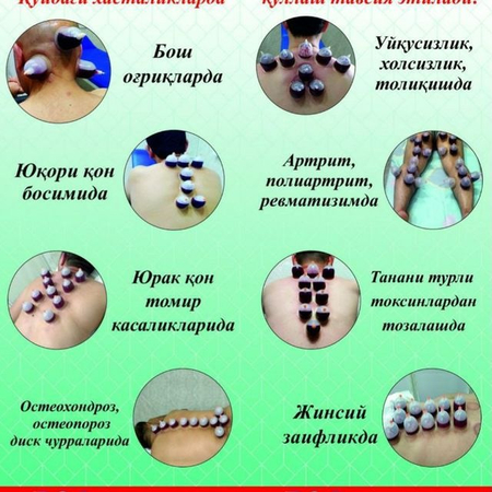 Xijoma 78 dardga davo...