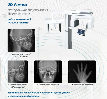 3D-рентгеновское устройство. Дентальный 3Д рентген панорамный