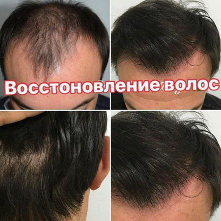 Косметолог с Мед.образованием  для мужчин и женщин