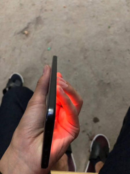 Redmi not 11 garantiya