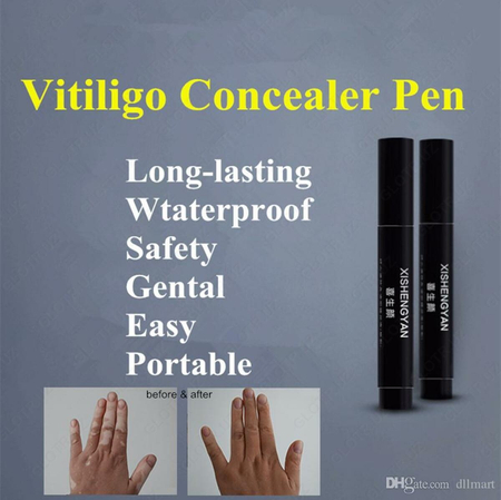 Витилиго фломастер. Vitiligo flomaster