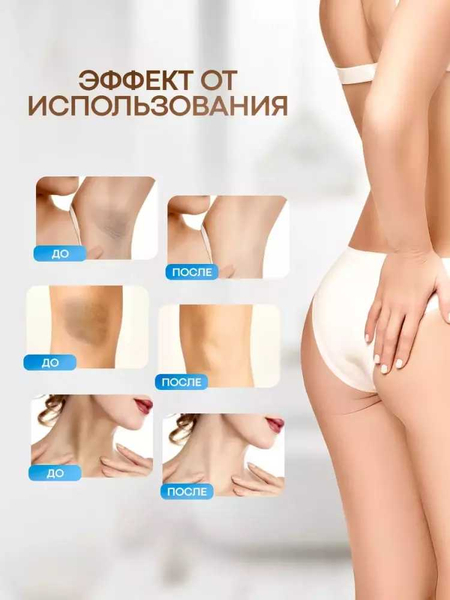 Bikini zonasini oqartiruvchi krem