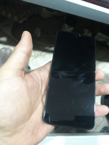 Redmi Note 11 S holati yaxshi
