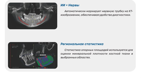 3D-рентгеновское устройство. Дентальный 3Д рентген панорамный