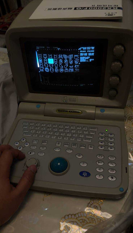 УЗИ KX2000F/G в идеальном состоянии