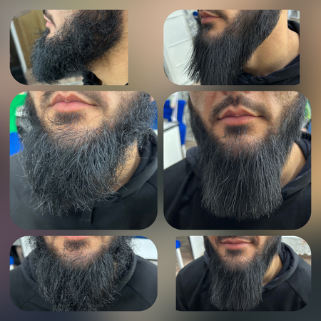 Keratin,  Nonaplastika , bustap