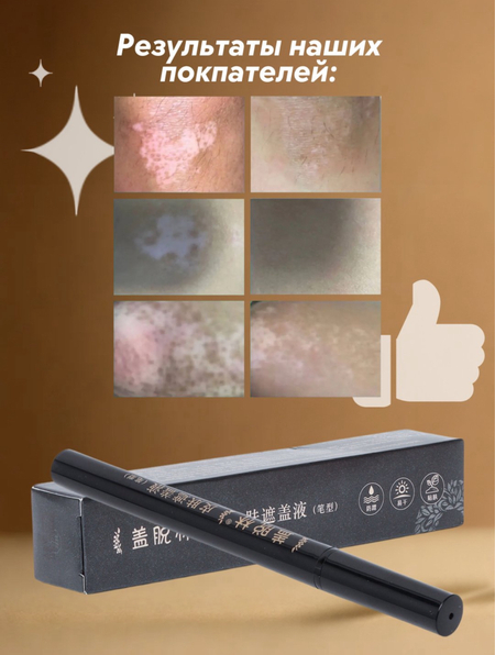 Фломастер от витилиго. Vitiligo flomaster