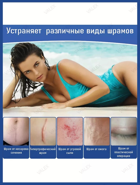Силиконовый пластырь для лечения шрамов и рубцов