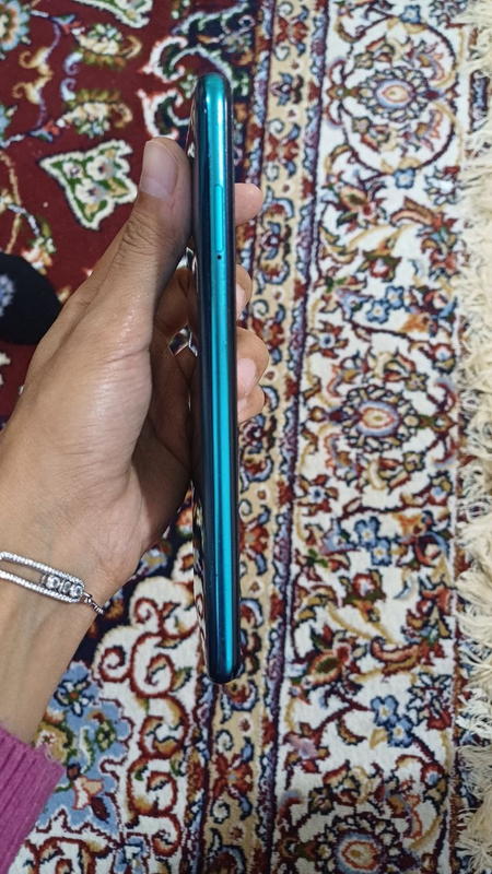 Telefon Redmi sostayanisi zur hamma narsasi ishlidi