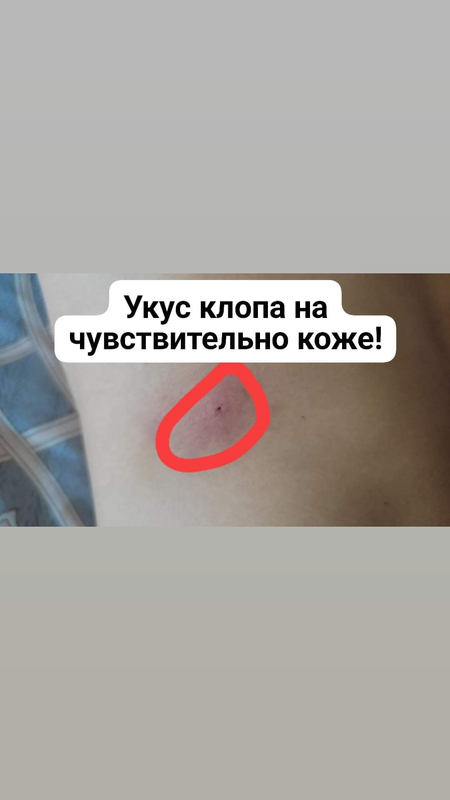 Уничтожение насекомых и грызунов!