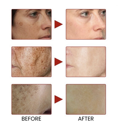 Retinol Mooyam brendi