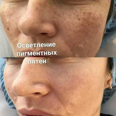 Косметолог с медицинским образованием