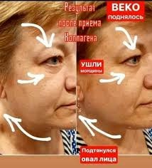 Коллаген фокс 5000мг плюс Турция, collagen fox 5000mg plus turkiya