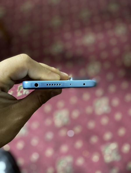 Redmi Not 11 xolati yaxshi