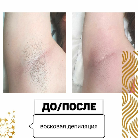 Manikyur,pedikyur,shlak ,depilyatsiya xizmatlarimiz bor